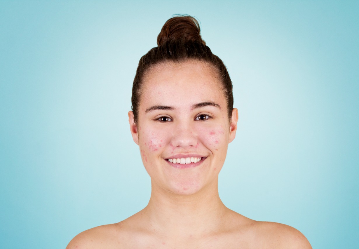 Whitehead Treatment In Gainesville, FL